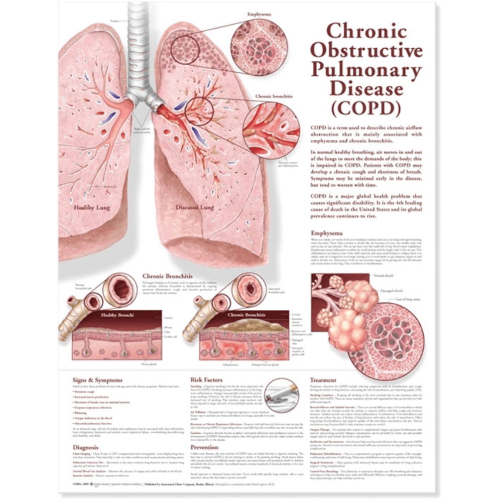 Chronic Obstructive Pulmonary Disease Anatomical Chart – Medshop Australia